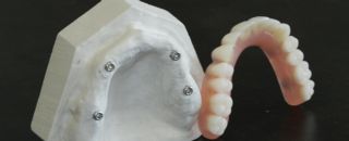 Velkommen til Klinisk Tandtekniker Heidi Wulff